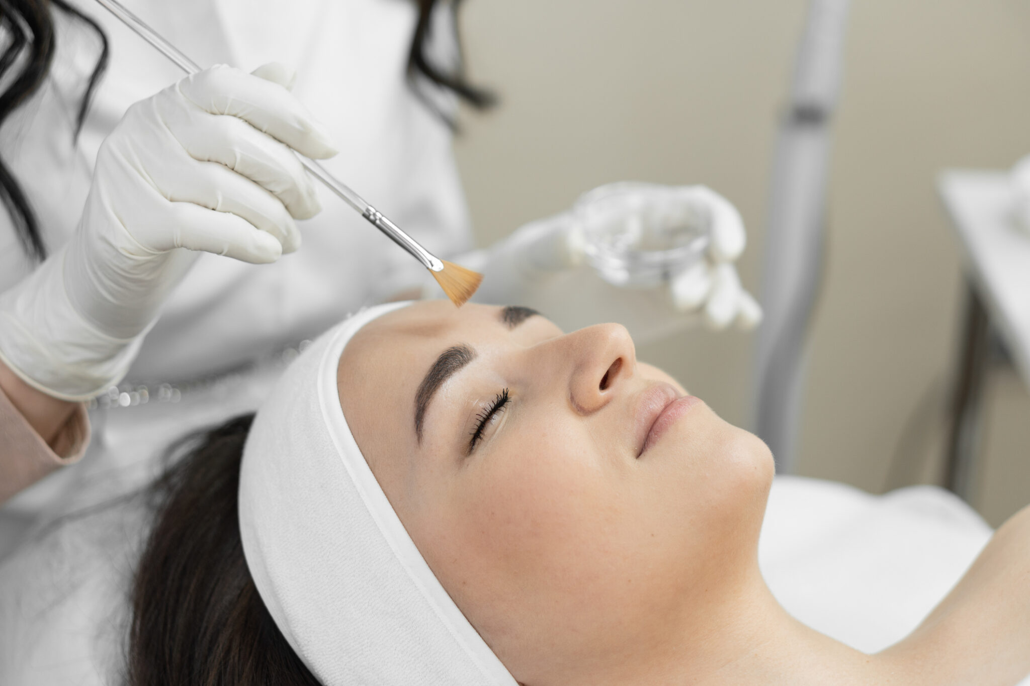Peels - Reveal MedSpa